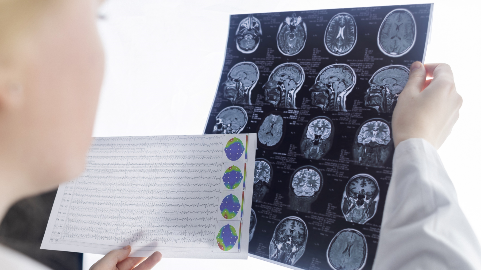 Pioneering New Frontiers: Ovid Therapeutics' Journey to Revolutionize ...