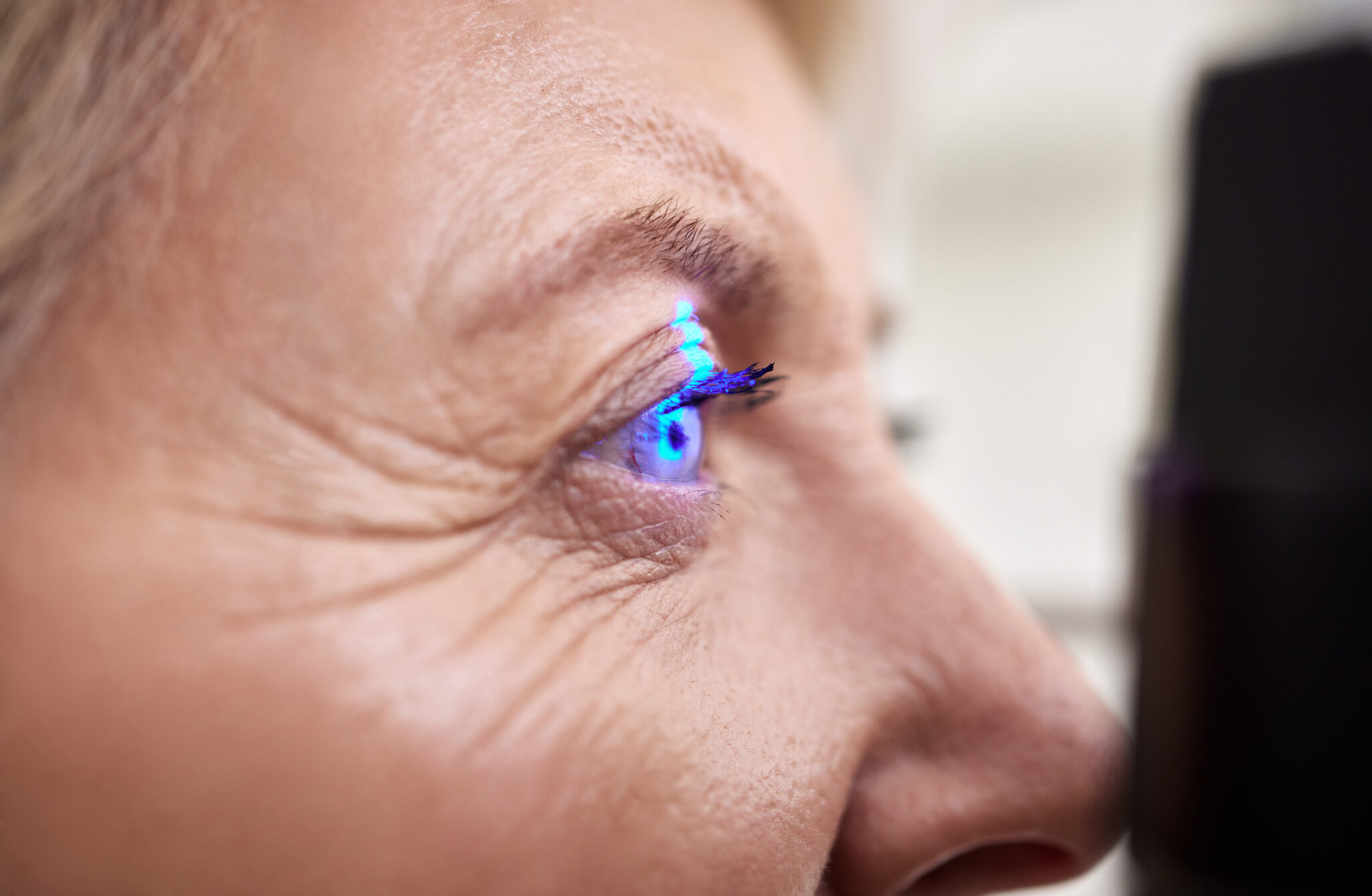 Laser Vision: Pioneering Laser Innovations for Presbyopia ft. Ace ...