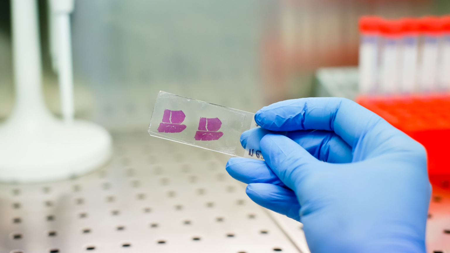 MASH Clinical Trials: New Approaches and Methodologies - Xtalks