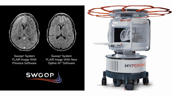 Optive AI Gets FDA Clearance, Elevates Image Quality for Swoop Portable ...