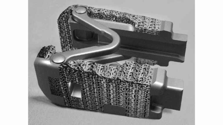 Spine Innovation’s LOGIC Titanium Device Cleared for Use in Spinal ...