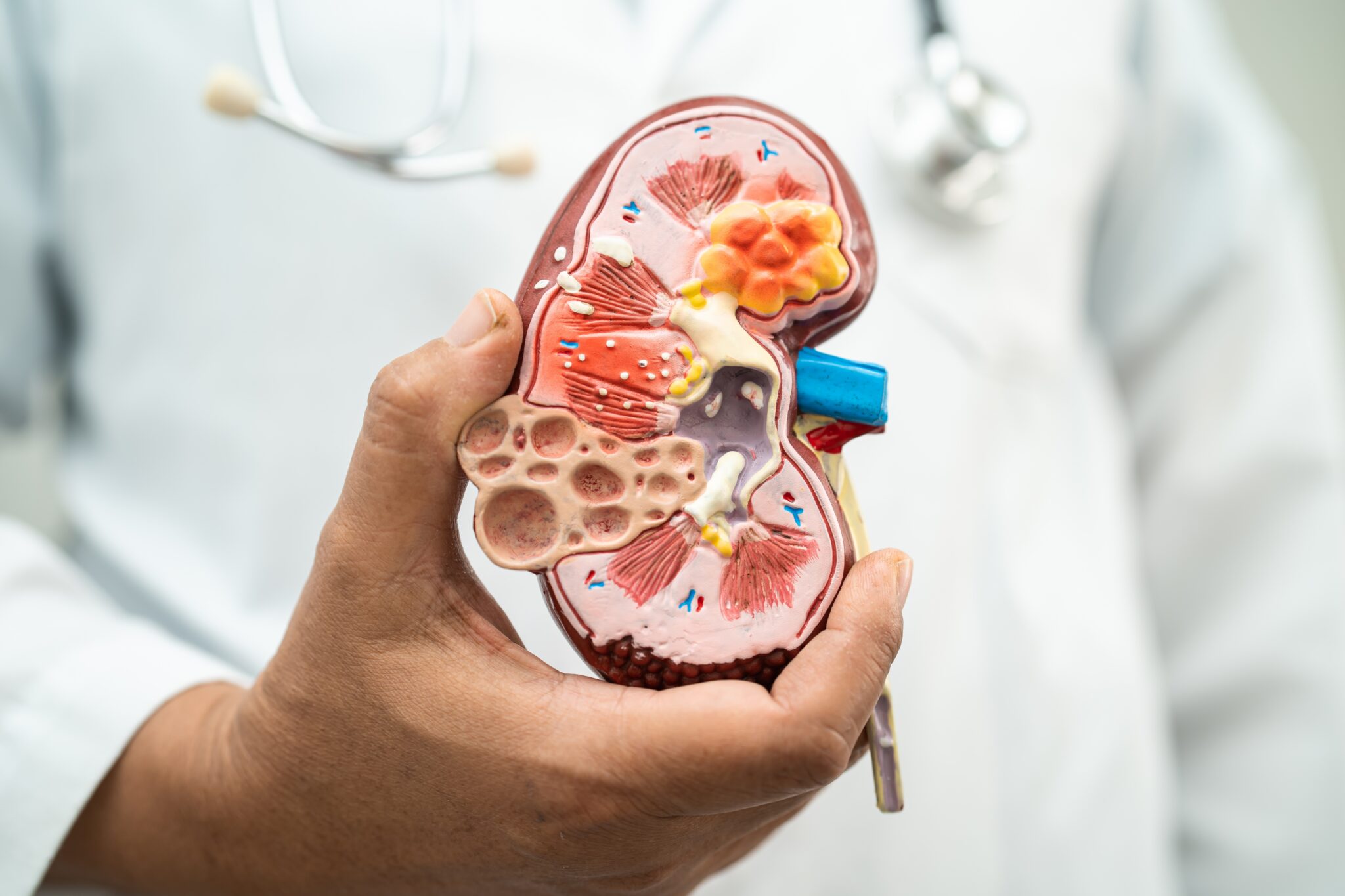 National Kidney Month 2026: Breakthrough Kidney Disease Therapies - Xtalks
